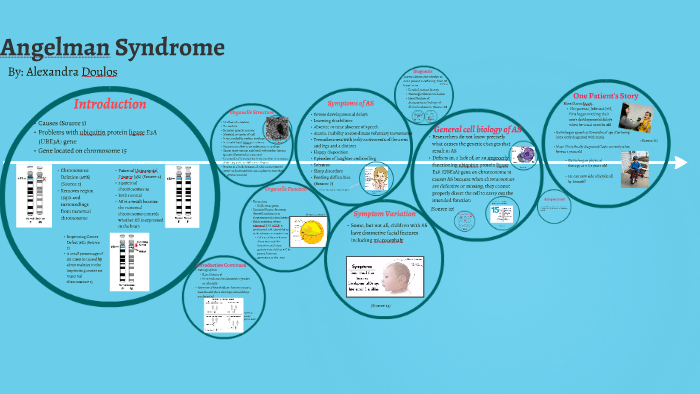 Angelman Syndrome Presentation by Alexandra Doulos on Prezi