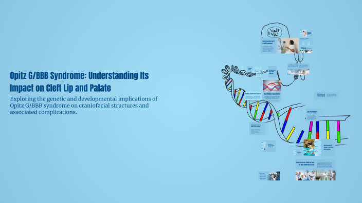 Opitz G/BBB Syndrome: Understanding Its Impact on Cleft Lip and Palate ...