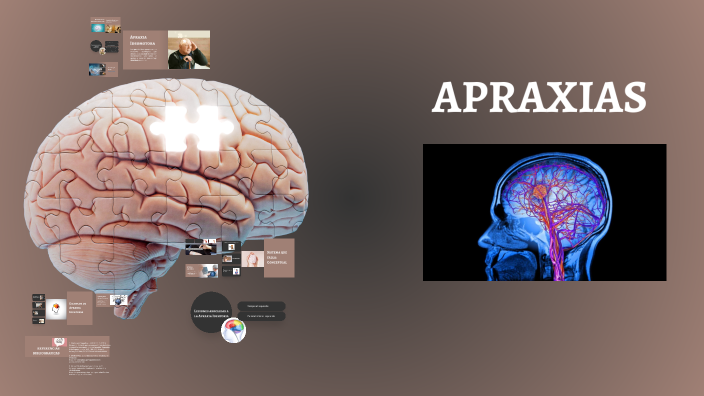 Apraxia: ideomotora e ideatoria by GENESIS LISBETH CALDERON MAITA on Prezi