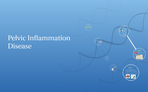 Pelvic Inflammation Disease by Michelle Castelan on Prezi