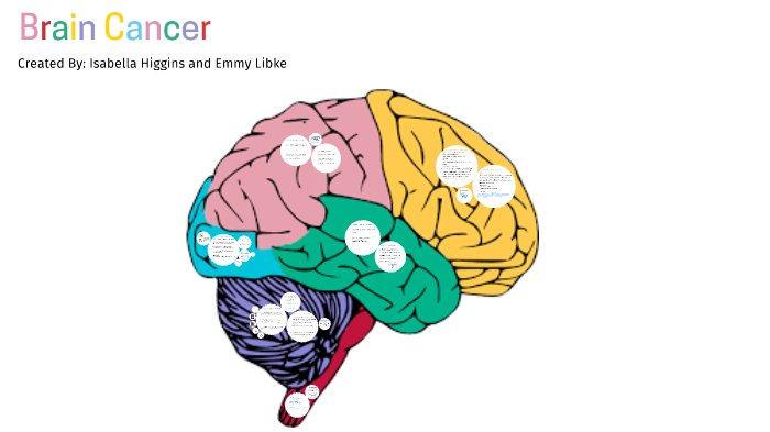Brain Cancer Project by Emmy Libke on Prezi