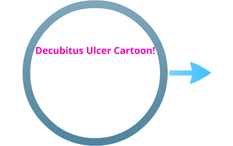 decubitus ulcers by Deanna Battis on Prezi