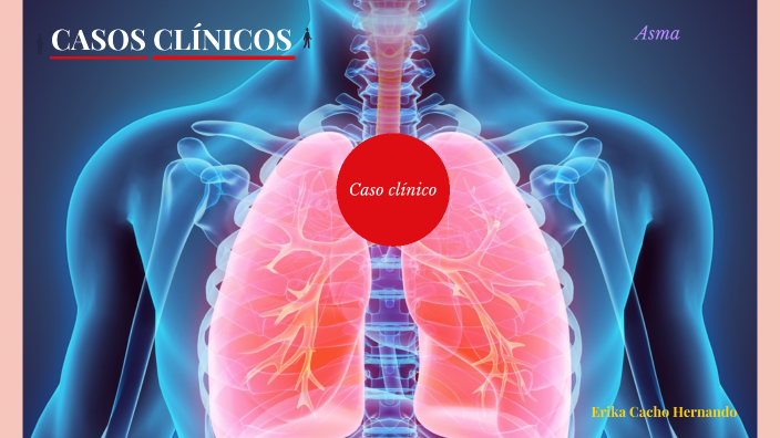 Fundamentos by Erika Cacho on Prezi