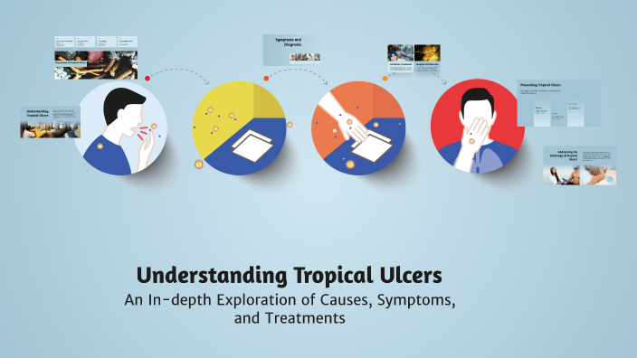 Understanding Tropical Ulcers by Ahmed Mohamed on Prezi