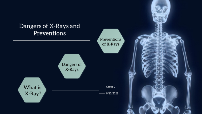 Dangers of X-Rays and Preventions by Su Ya Ti on Prezi
