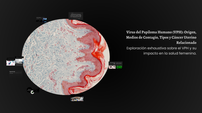 Virus del Papiloma Humano (VPH): Origen, Medios de Contagio, Tipos y ...