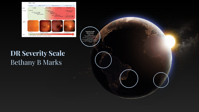 DR Severity Scale by Bethany Marks on Prezi