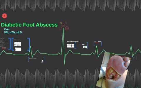 Diabetic Foot Abscess by Jessie Teo on Prezi