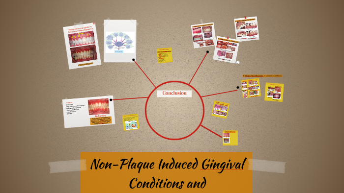 Non-Plaque Induced Gingivitis by cococo cacaca on Prezi