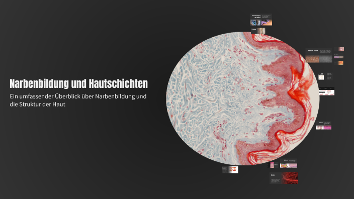 Narbenbildung und Hautschichten by Sebastian Kroehnert on Prezi