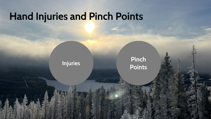 Hand Injuries and Pinch Points by sidney bennie on Prezi