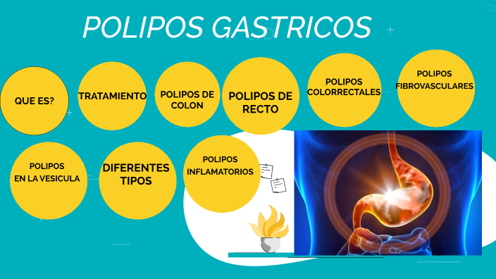 POLIPOS by kelly Rodriguez on Prezi