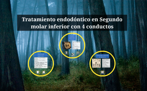 Segundo molar inferior con 4 conductos by Camila Contreras on Prezi