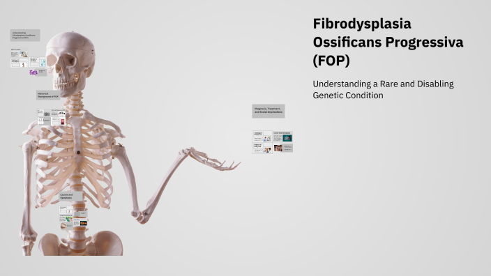 Fibrodysplasia Ossificans Progressiva (FOP) by Dea Jaf on Prezi