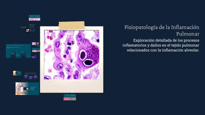 Fisiopatología de la Inflamación Pulmonar by Cesar Rey on Prezi