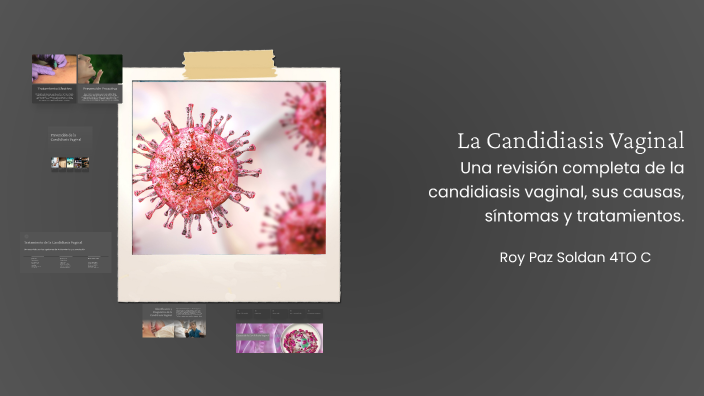 La Candidiasis Vaginal by roy paz soldan on Prezi