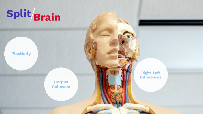 Split Brain by Lance Kinsey on Prezi