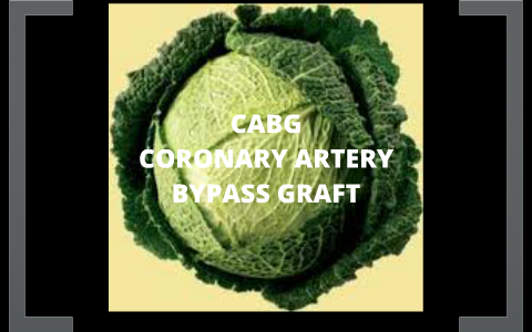 CABG by Lucy Worlock on Prezi