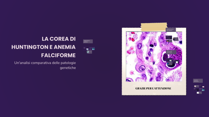 LA COREA DI HUNTINGTON E ANEMIA FALCIFORME by Ludovico Manzato on Prezi