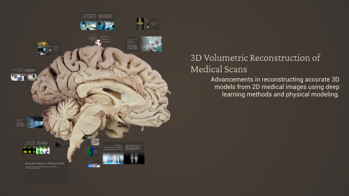 3D Volumetric Reconstruction of Medical Scans using Deep Learning by ...