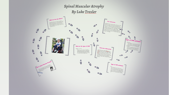 Spinal Muscular Atrophy by Luke Trexler on Prezi
