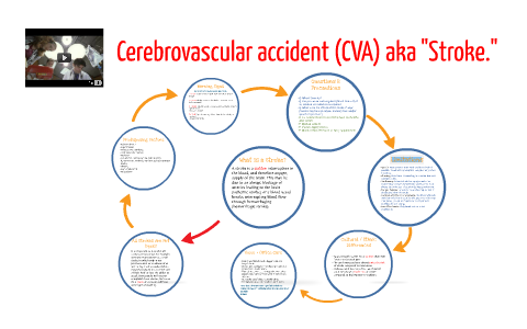 Cerebrovascular accident (CVA) aka "Stroke." by Michael Christopher on ...