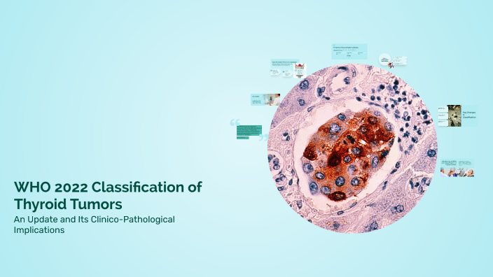 WHO 2022 Classification of Thyroid Tumors by Yasmin Tarek Elserry on Prezi