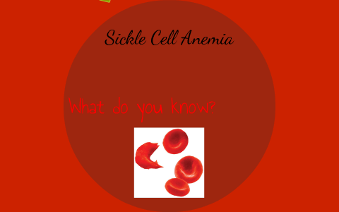 Sickle Cell Anemia by Kayla Pahl on Prezi