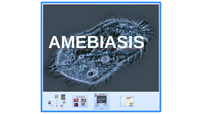 ¿Qué es la amibiasis? by william quintero on Prezi