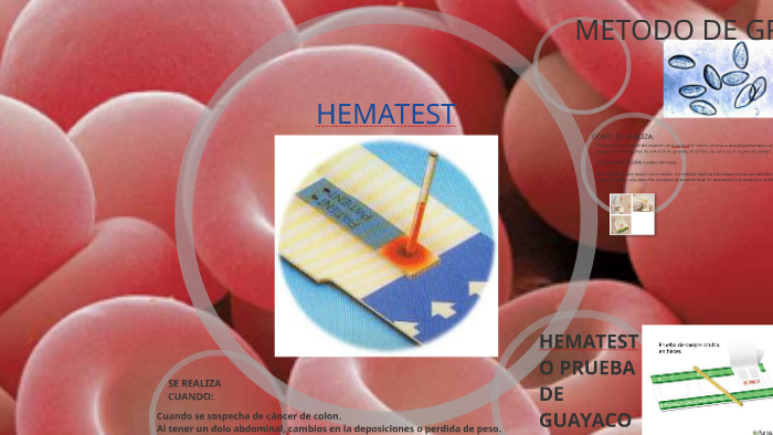 HEMATES by zulay edith lazaro machuca on Prezi