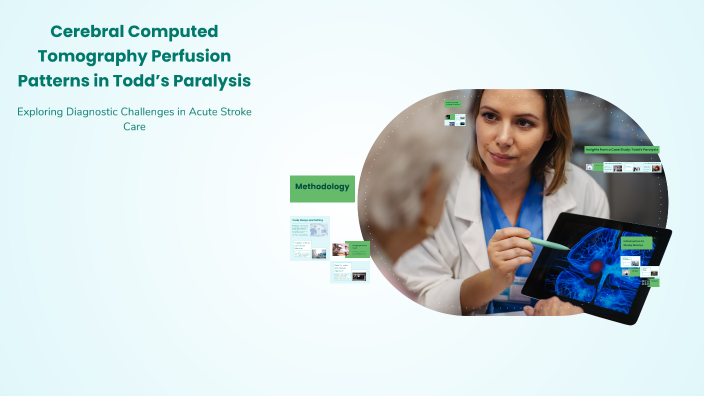 Cerebral Computed Tomography Perfusion Patterns in Todd’s Paralysis by ...