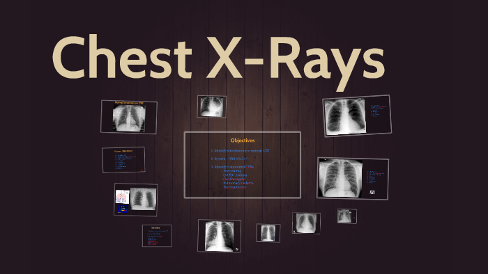 Chest X-Rays by Zafar Smith on Prezi
