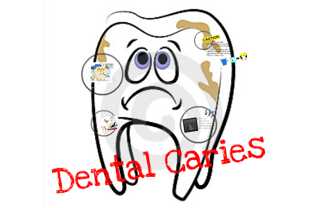 Dental Caries by Tyler Parchment on Prezi