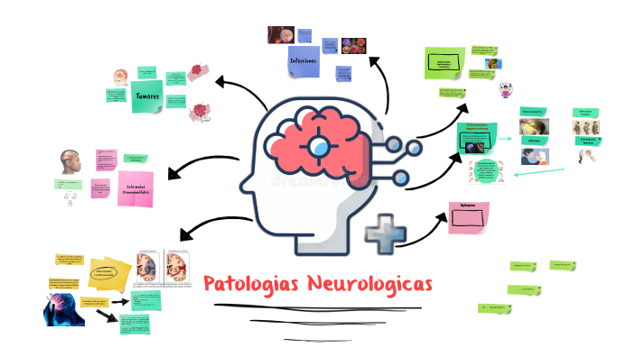 Patologias neurologicas by Adonis Ordoñez on Prezi