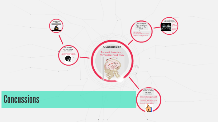 Concussion visual aid by Patrick K on Prezi