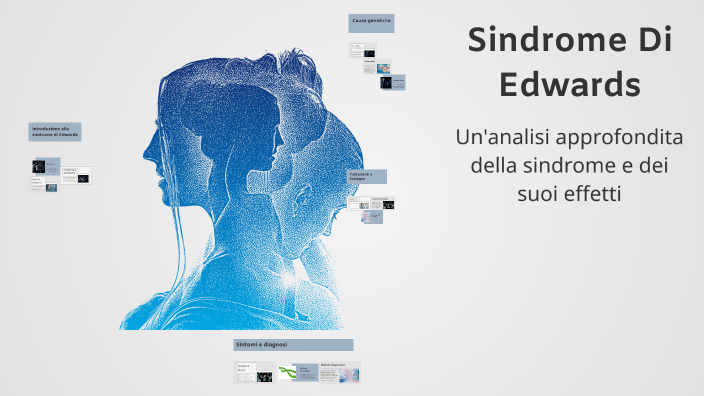 Sindrome Di Edwards by alessandro1 scelza on Prezi