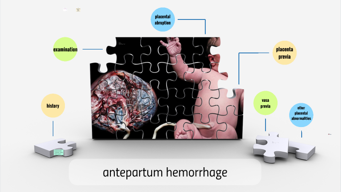 Placental problems by Dunya Abubakir on Prezi