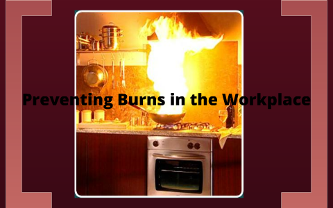 Preventing Burns in the Workplace by Yajaira Borja on Prezi