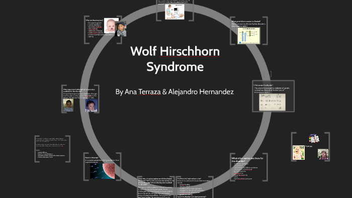 Wolf Hirschhorn Syndrome by Alejandro Sarmiento on Prezi