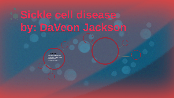 Sickle cell disease by Daveon Jackson on Prezi
