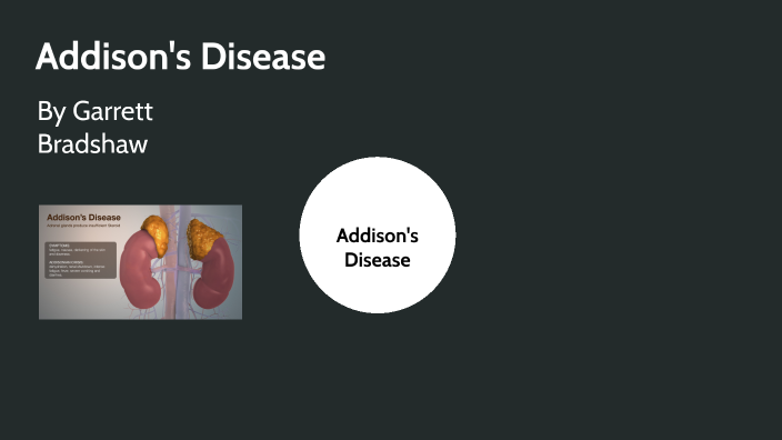 Endocrine Disease by Garrett Bradshaw on Prezi