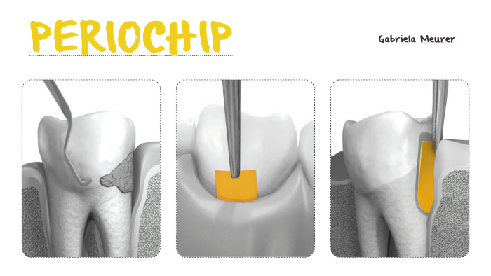 PERIOCHIP by Gabriela Meurer on Prezi