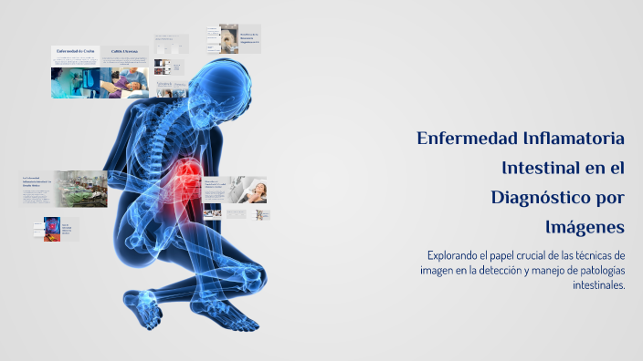 Enfermedad Inflamatoria Intestinal En El Diagnóstico Por Imágenes By