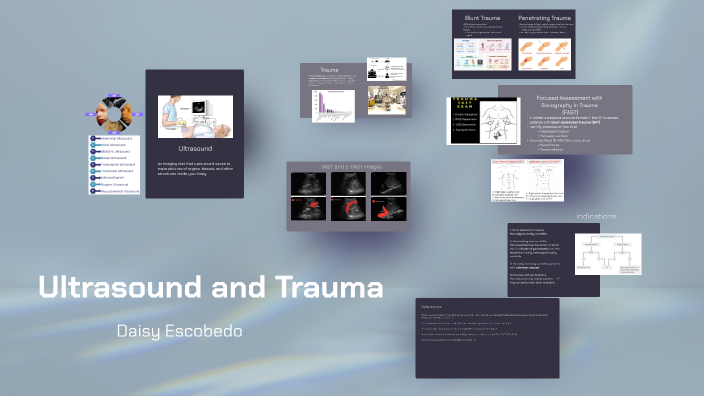Ultrasound and Trauma by Daisy Escobedo on Prezi