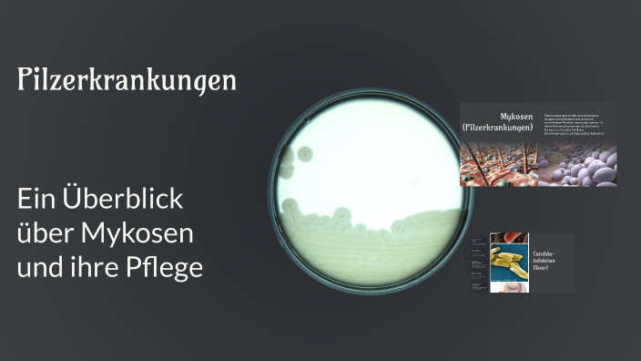 Pilzerkrankungen by Anandhu Mathilakam on Prezi