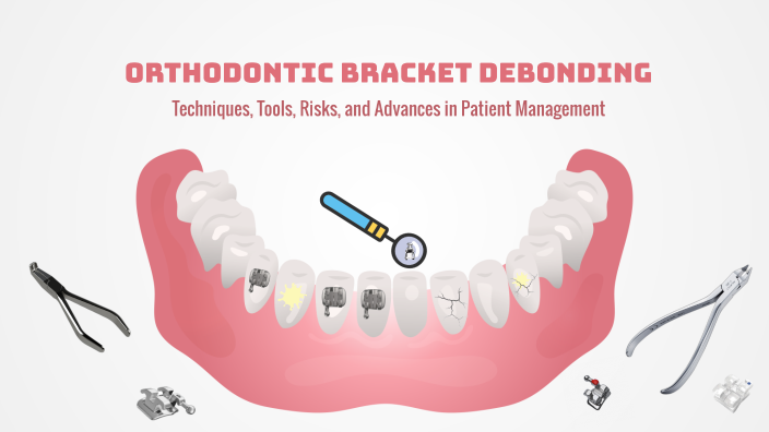 Orthodontic Bracket Debonding by Jana Awar on Prezi