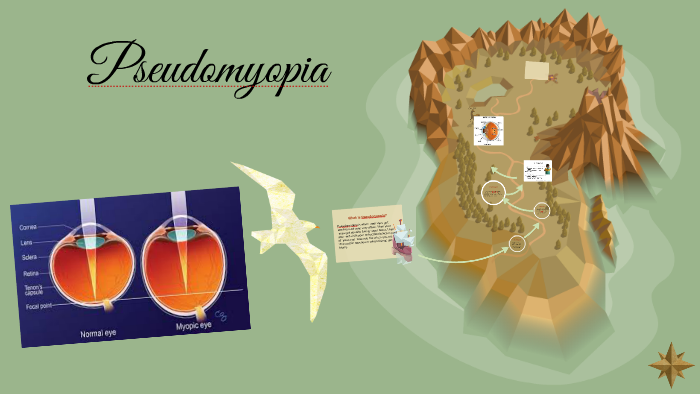 Pseudomyopia by Lirah Zhu on Prezi