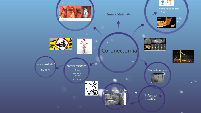 Coronectomía by Sayi Rodriguez on Prezi