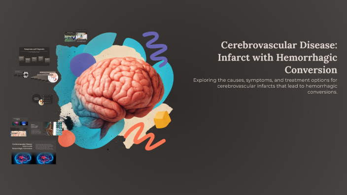 Cerebrovascular Disease: Infarct with Hemorrhagic Conversion by Gloria ...