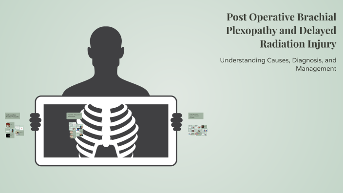 Post Operative Brachial Plexopathy and Delayed Radiation Injury by ...